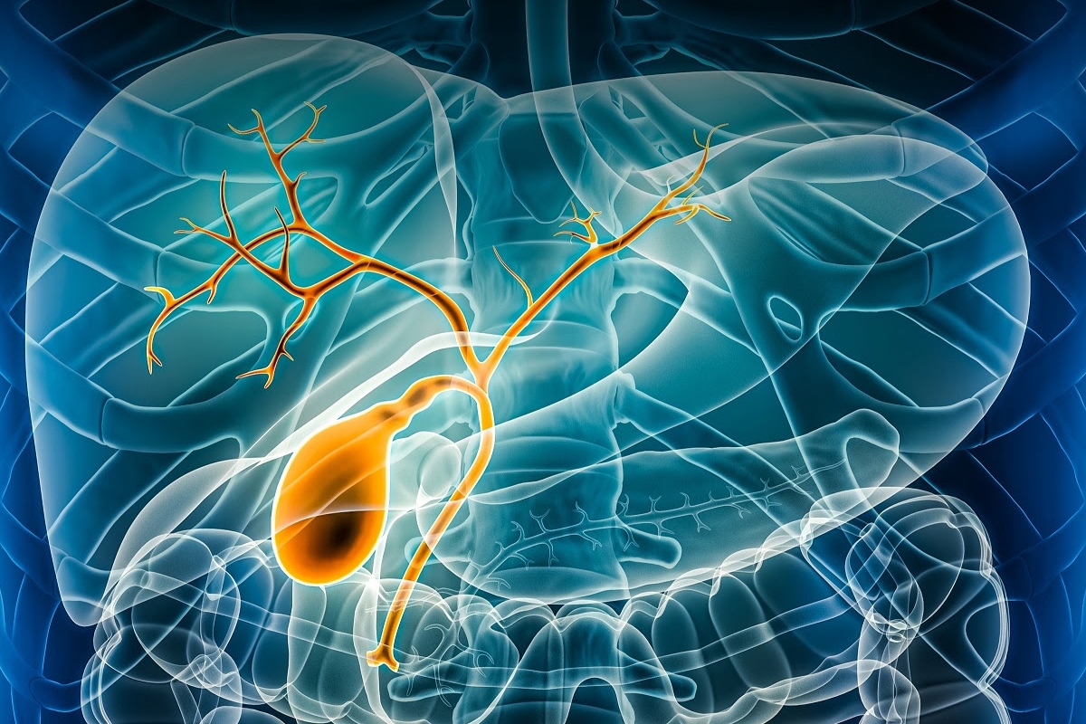 Colangiocarcinoma, una Lucha Silenciosa Contra el Cáncer de Vías ...